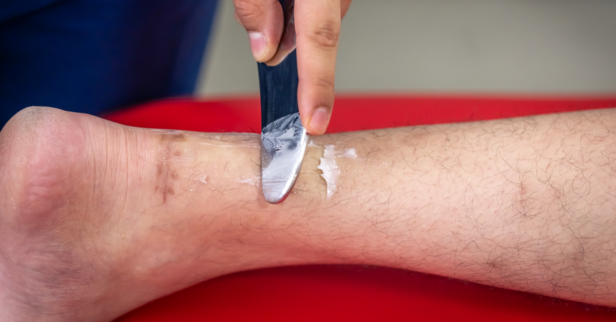 How Long Do Stitches Stay In? – Suture Kit