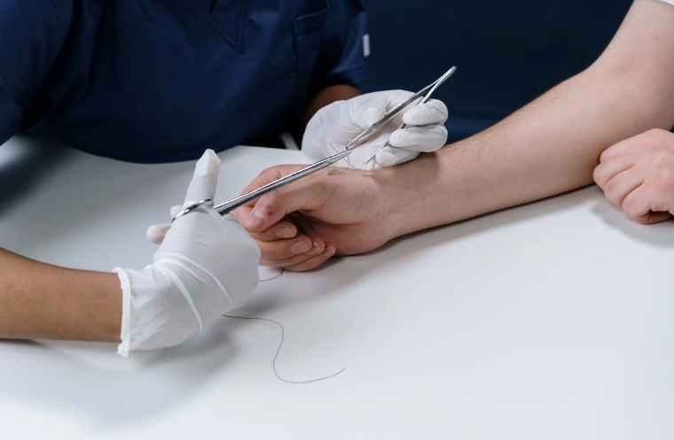 A Step-by-Step Guide for Proper Wound Care - Suture Kit