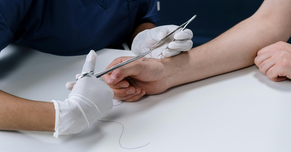 Stop Confusing Them: Sutures vs. Stitches Explained Once and for All ...