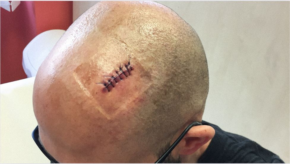 Suturing in ENT Surgery: Mastering Techniques for the Head and Neck ...